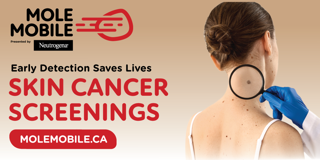 Melanoma Canada