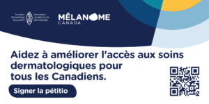 Melanome Canada